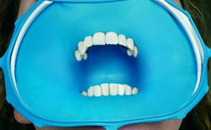 OptiDam Anterior Intro kit latex kofferdam gumi készlet Kerr